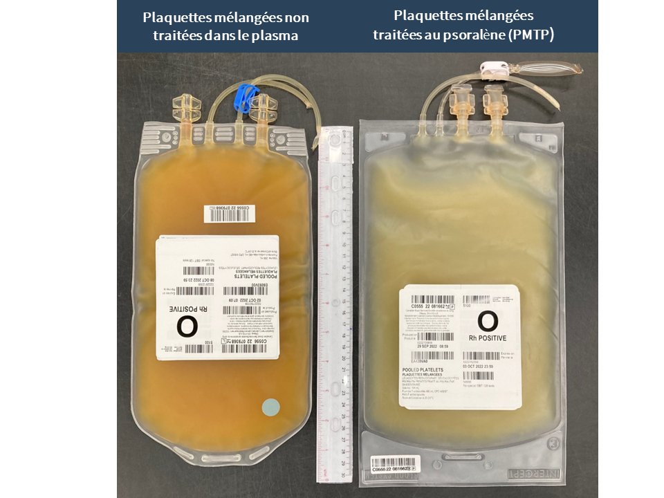Plaquettes à teneur réduite en agents pathogènes | Développement ...