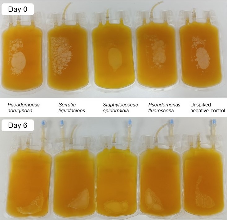 Plasma: Bacterial contamination | Professional Education