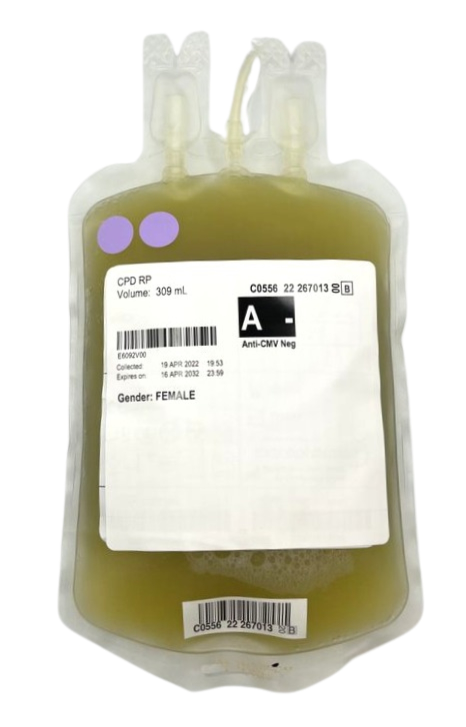 Plasma: Other causes of discolouration | Professional Education