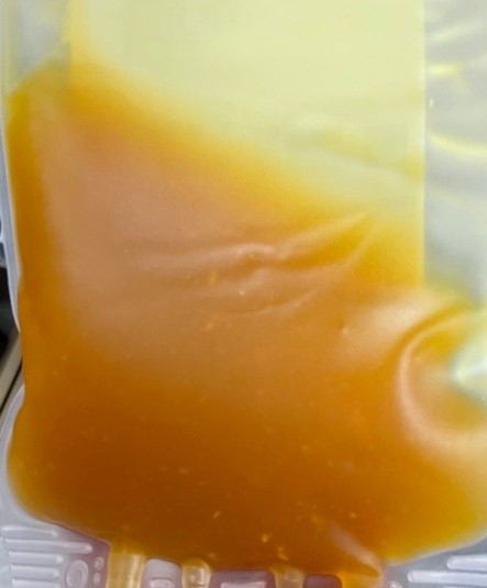 Platelets: Bacterial contamination | Professional Education