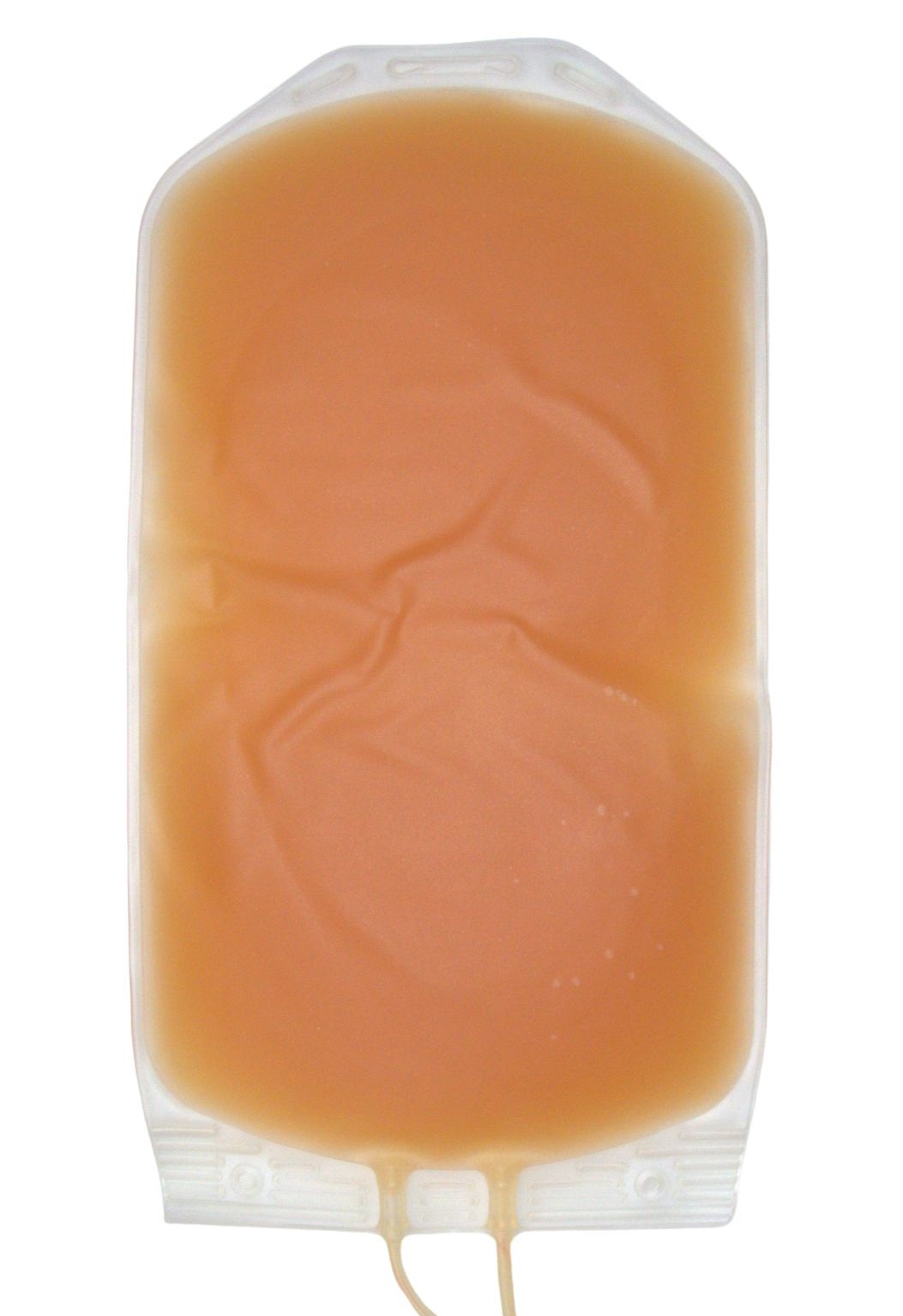 Platelets: Red blood cell contamination | Professional Education