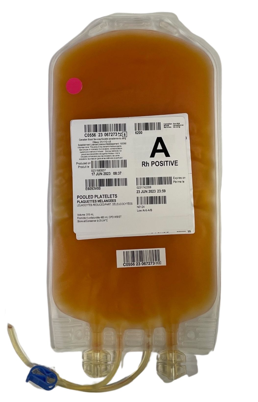 Platelets: Red blood cell contamination | Professional Education