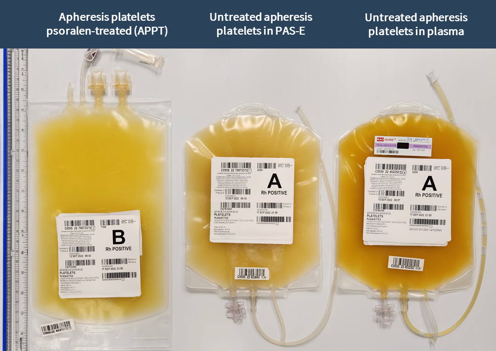 Platelets | Professional Education