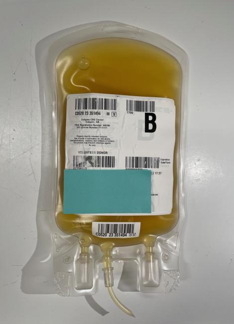 Plasma: Other causes of discolouration | Professional Education