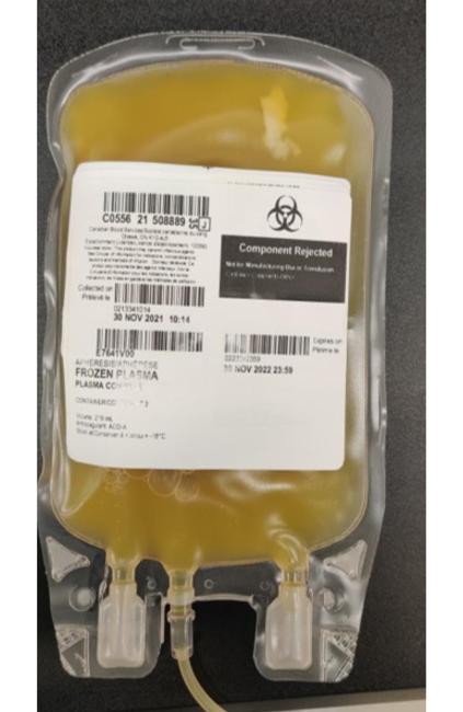 Plasma: Particulate matter | Professional Education