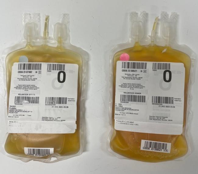 Plasma: Other causes of discolouration | Professional Education