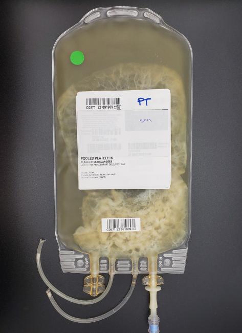 Platelets: Bacterial contamination | Professional Education