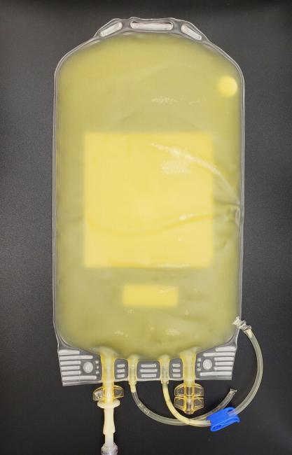 Platelets: Bacterial contamination | Professional Education