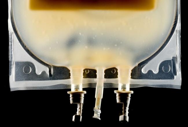 Platelets: Particulate matter | Professional Education