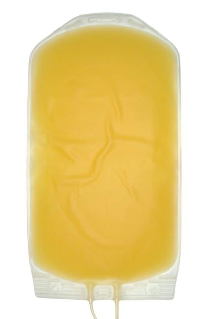 Platelets: Red blood cell contamination | Professional Education