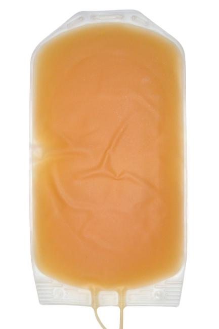 Platelets: Red blood cell contamination | Professional Education