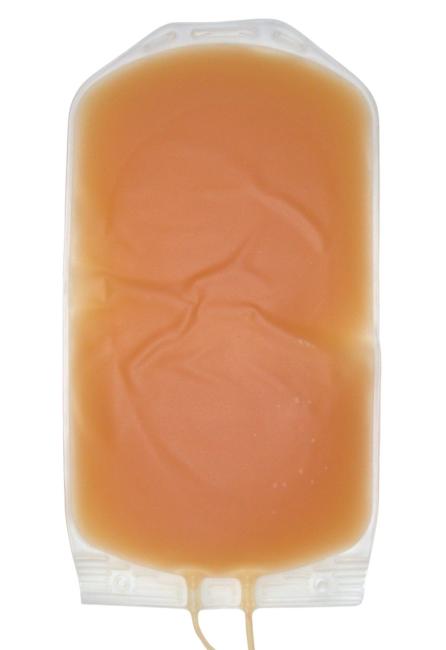 Platelets: Red blood cell contamination | Professional Education