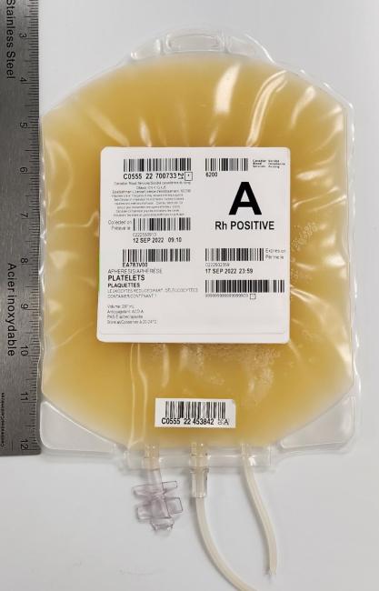 Platelets: Particulate matter | Professional Education