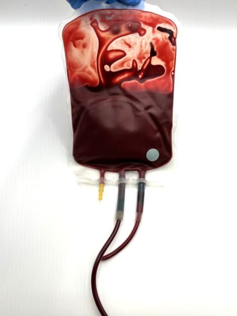 Red blood cells: Particulate matter | Professional Education