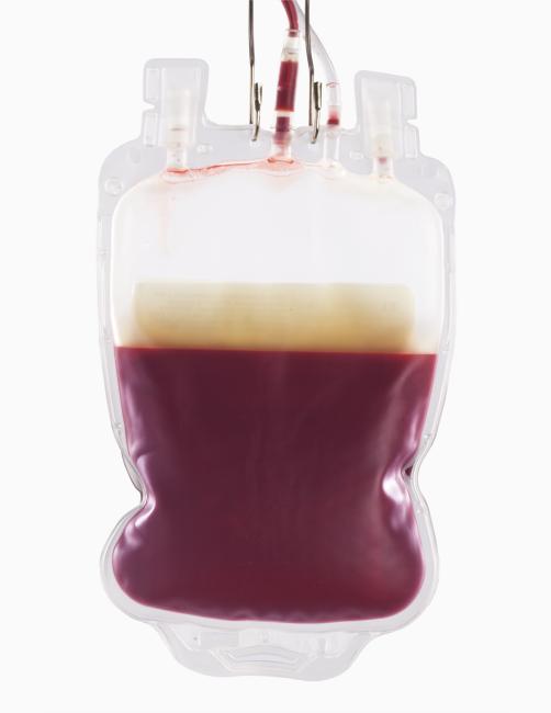 Red blood cells: Hemolysis | Professional Education