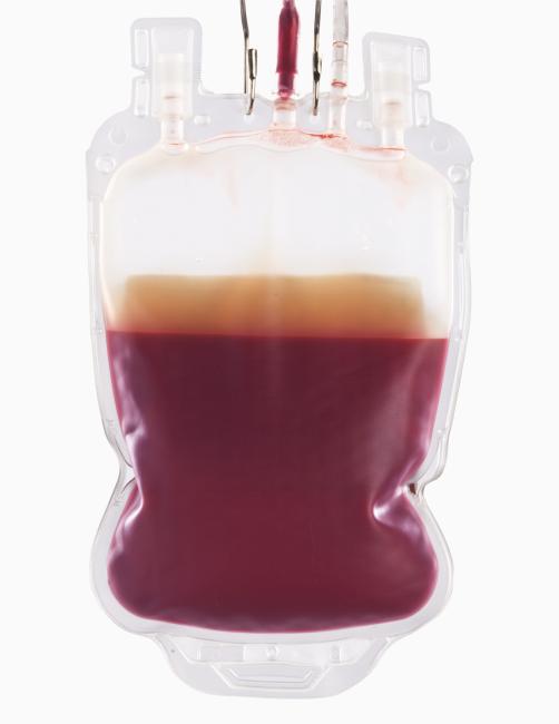 Red blood cells: Hemolysis | Professional Education