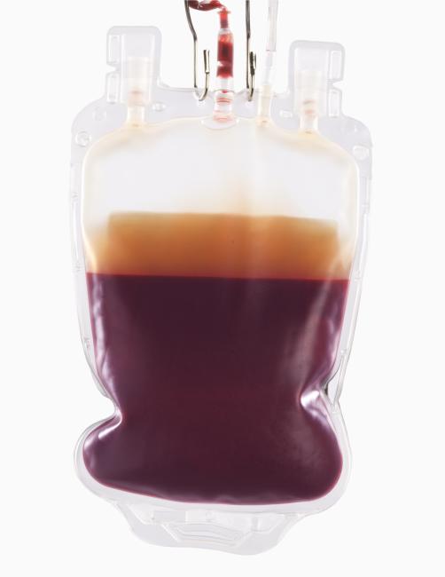 Red blood cells: Hemolysis | Professional Education