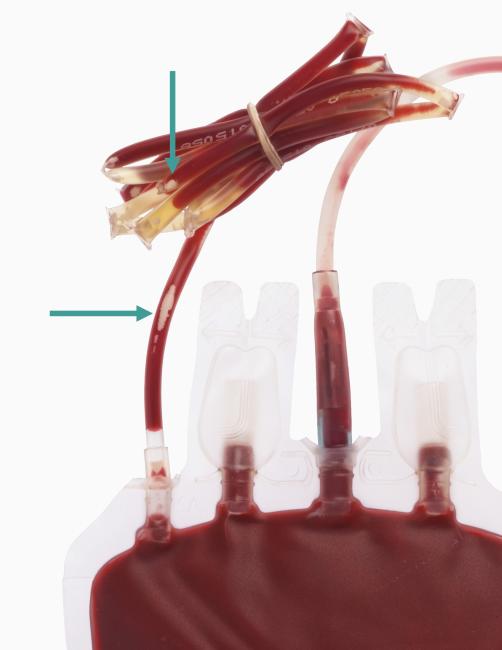 Red blood cells: Particulate matter | Professional Education